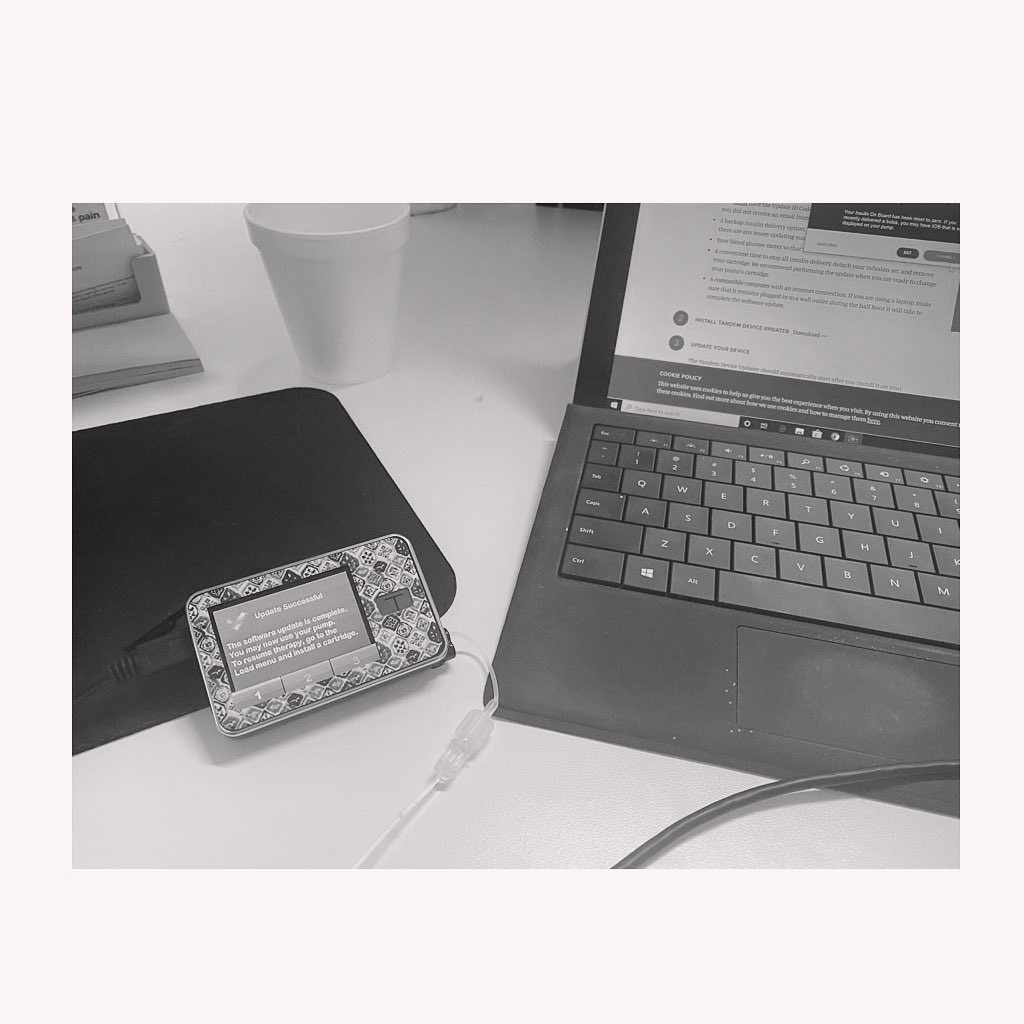 ControlIQ Review – T1D in the CLE