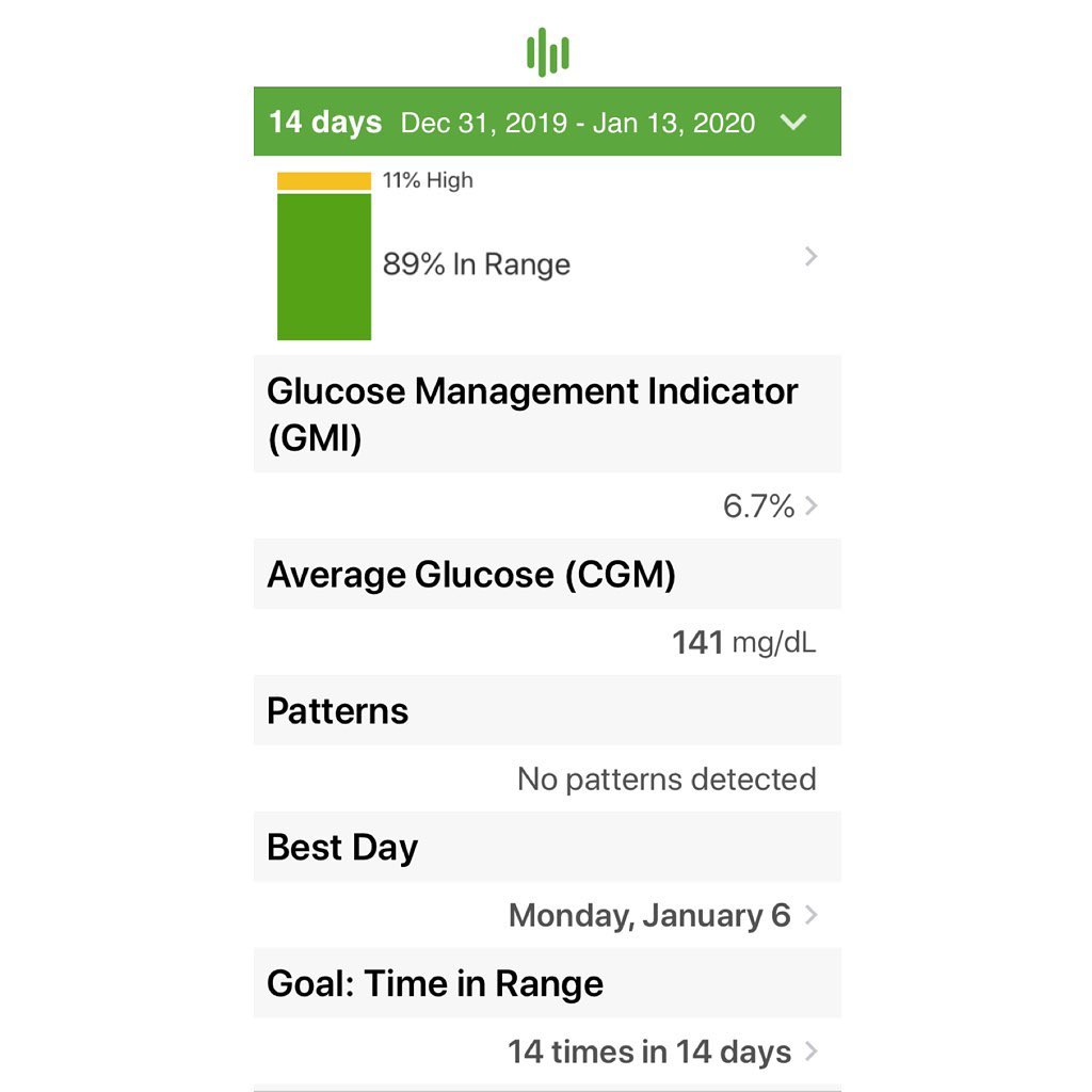 ControlIQ Review – T1D in the CLE