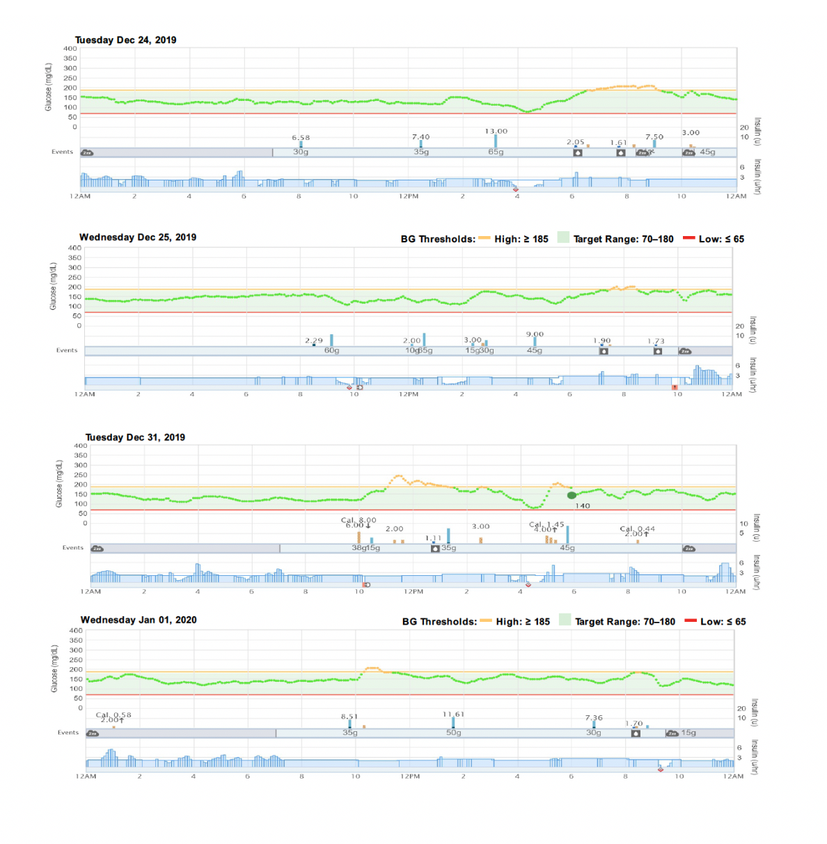 ControlIQ Review – T1D in the CLE
